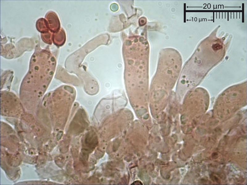 Basidio (Pag. 2): segue immagini - Glossario Illustrato Micologico